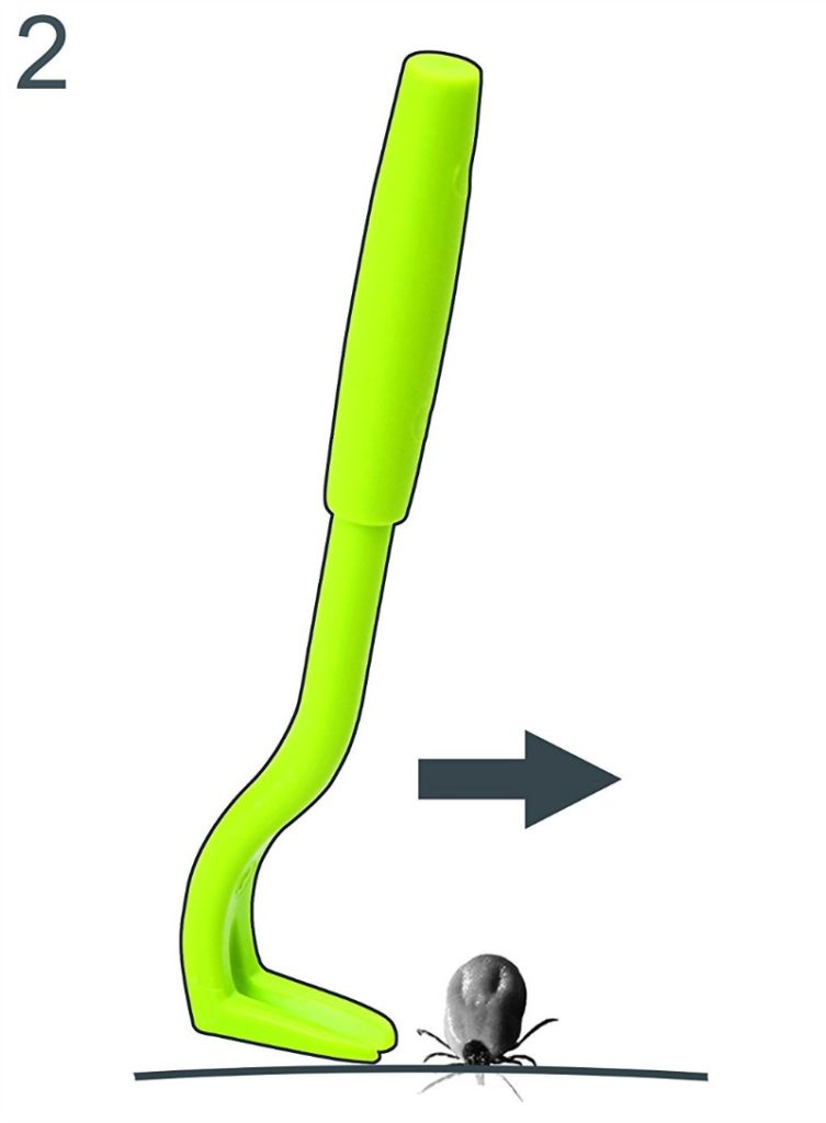 How to Remove a Tick Safely and Easily | Healthy Home Economist