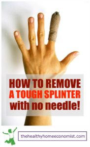 How to Remove a Splinter without a Needle | Healthy Home Economist