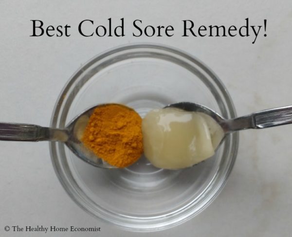 Effective Home Remedies for Cold Sores | Healthy Home Economist