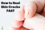 How to Heal Paper Cuts & Skin Fissures | Healthy Home Economist