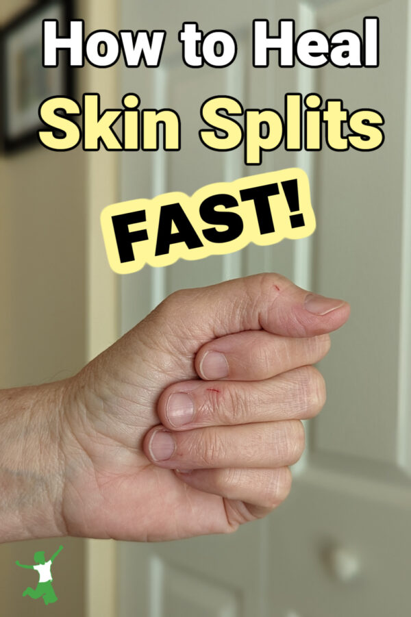 How to Heal Paper Cuts & Skin Fissures | Healthy Home Economist