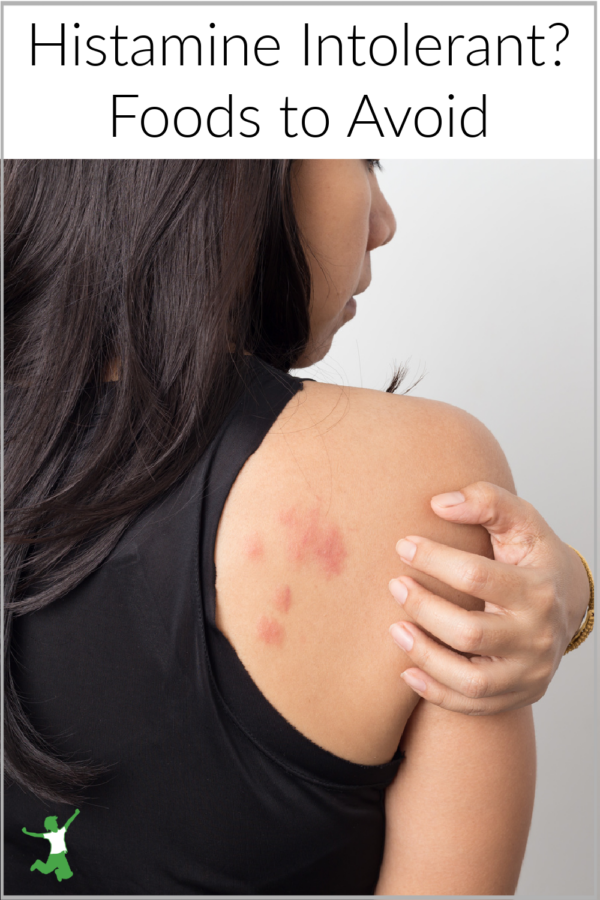 Histamine Intolerance, Ferments & Acne | Healthy Home Economist